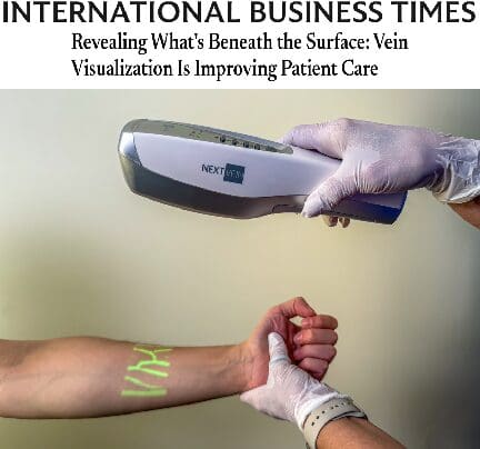 IBTimes Highlights Benefits of Vein Visualization in Patient Care