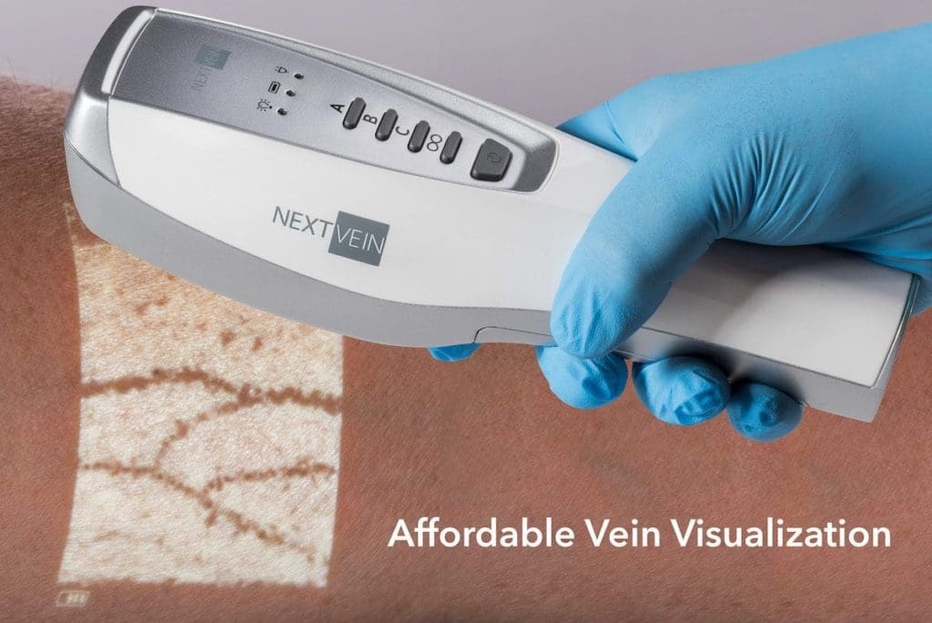 NextVein's Vein Visualization Technology