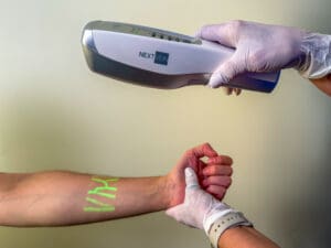 The Complete Guide to Vein Finder Technology